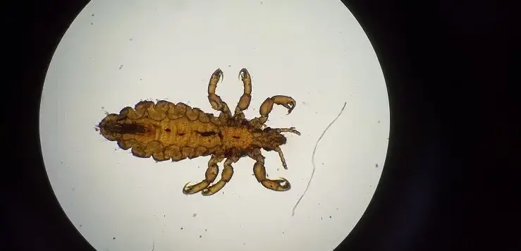 HOW TO AVOID LICE IN THE CHICKEN COOP? TIPS AND TRICKS TO GET RID OF ...